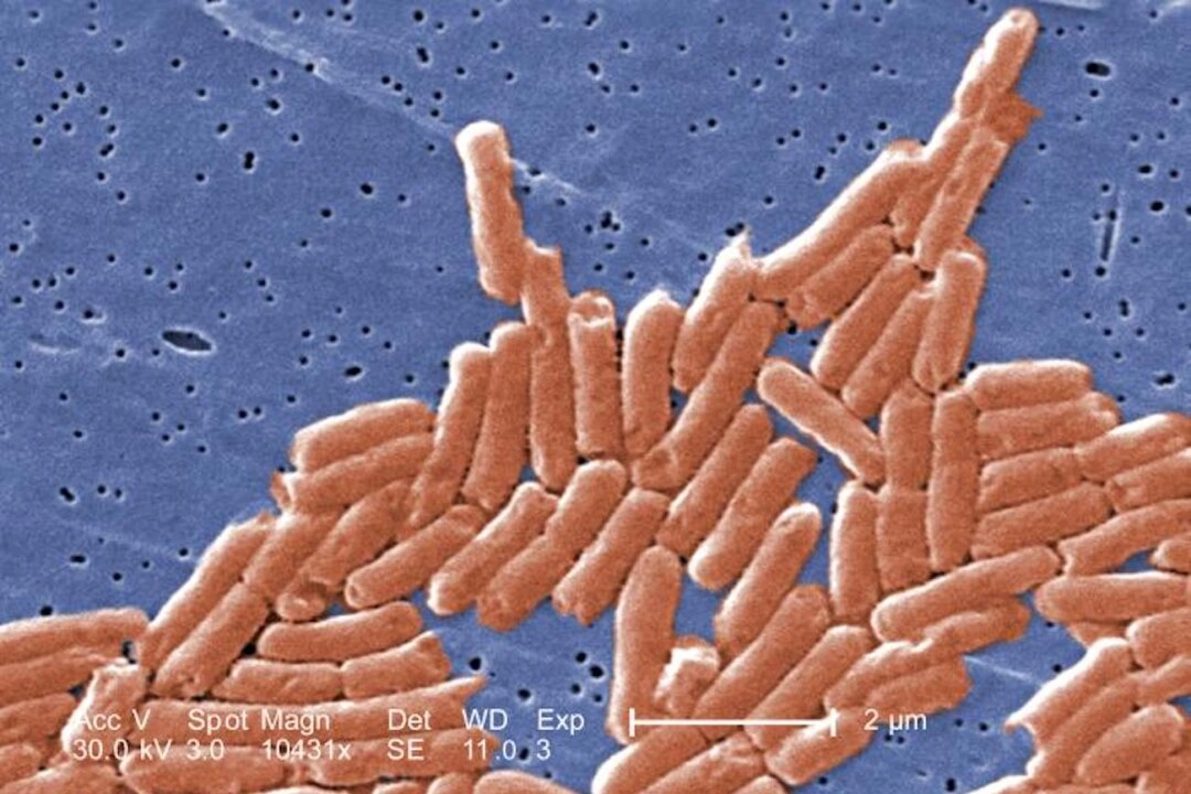 Los CDC advierten que brote de Salmonella en 10 estados - Últimas noticias veraces de EE.UU ...
